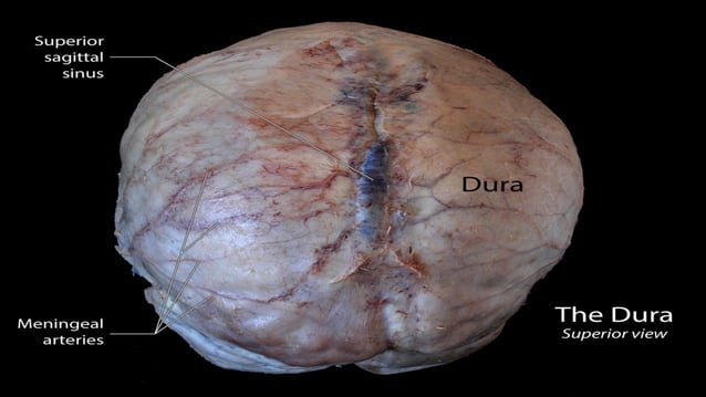 meninges, Dural sinuses and CSF circulation.pptx