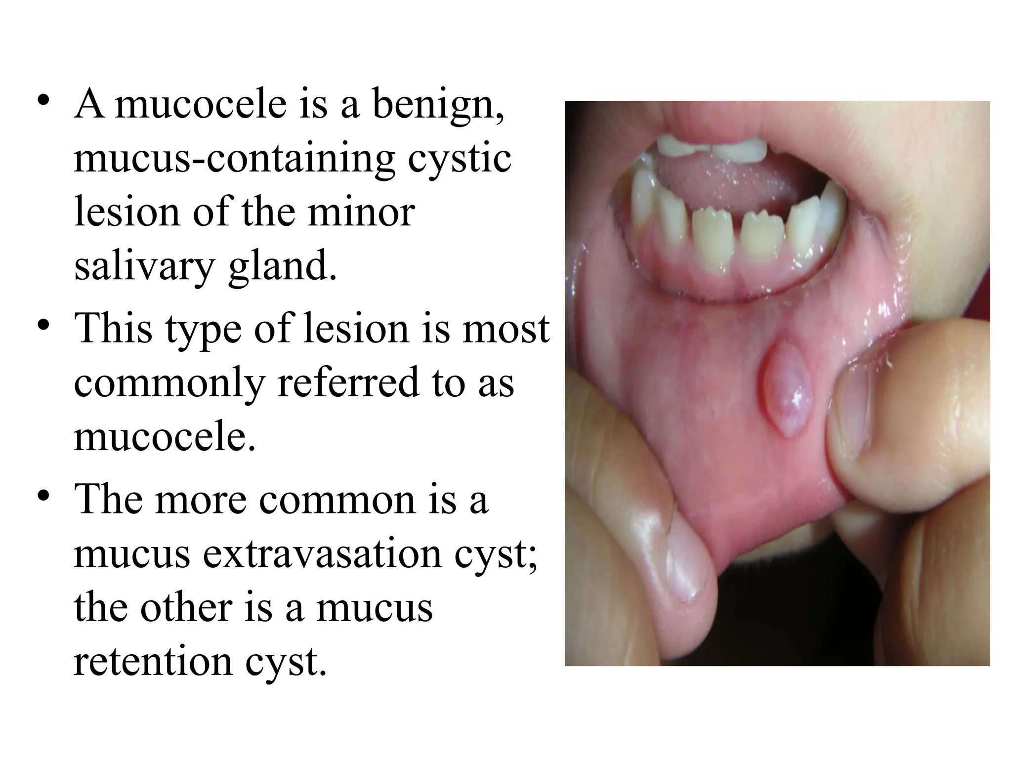 the clinically oriented anatomy of the salivary glands | PPTX