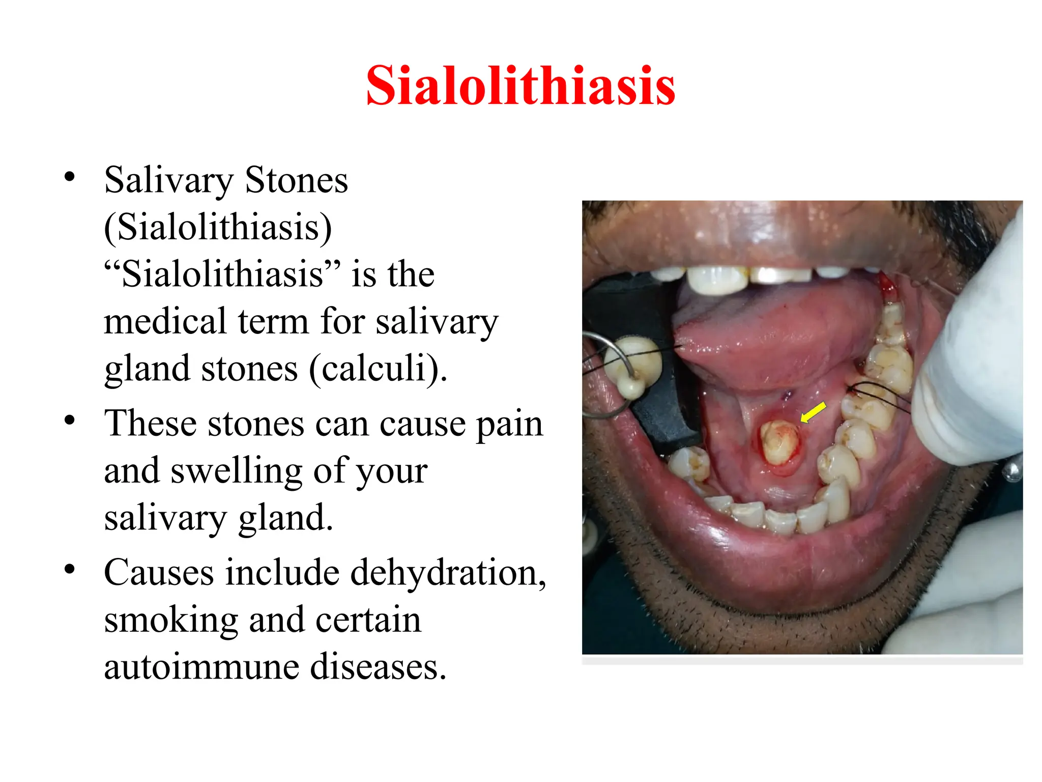 the clinically oriented anatomy of the salivary glands | PPTX