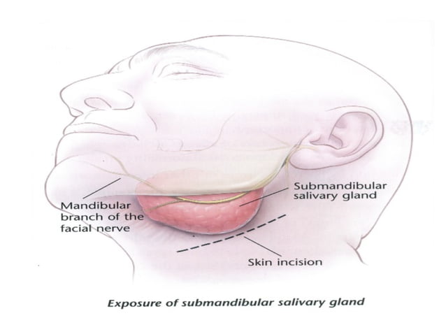 the clinically oriented anatomy of the salivary glands | PPT