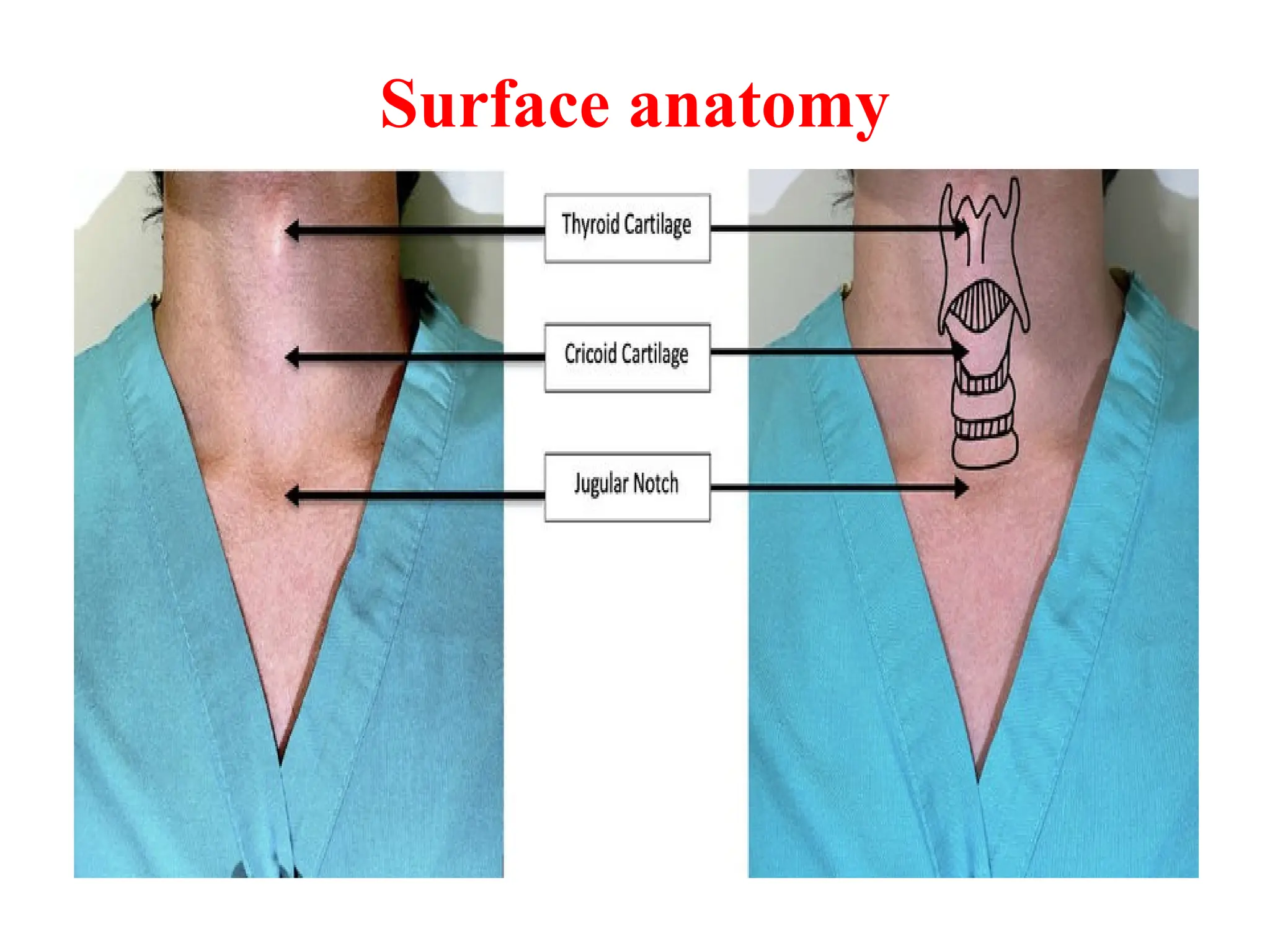 the complex anatomy of the neck; clinically oriented | PPTX