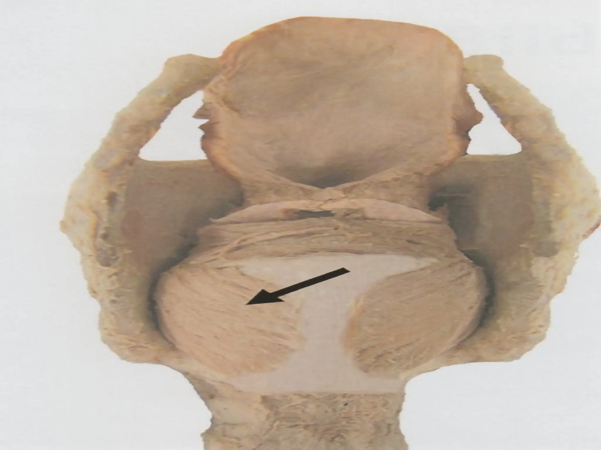 clinically oriented anatomy of pharynx and larynx | PPTX