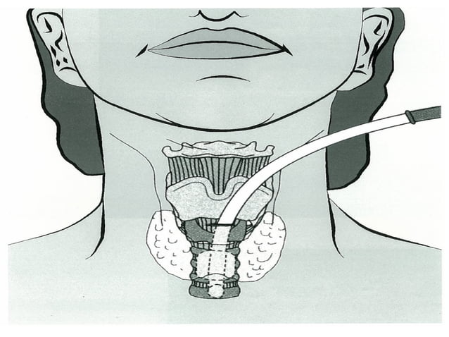 clinically oriented anatomy of pharynx and larynx | PPTX