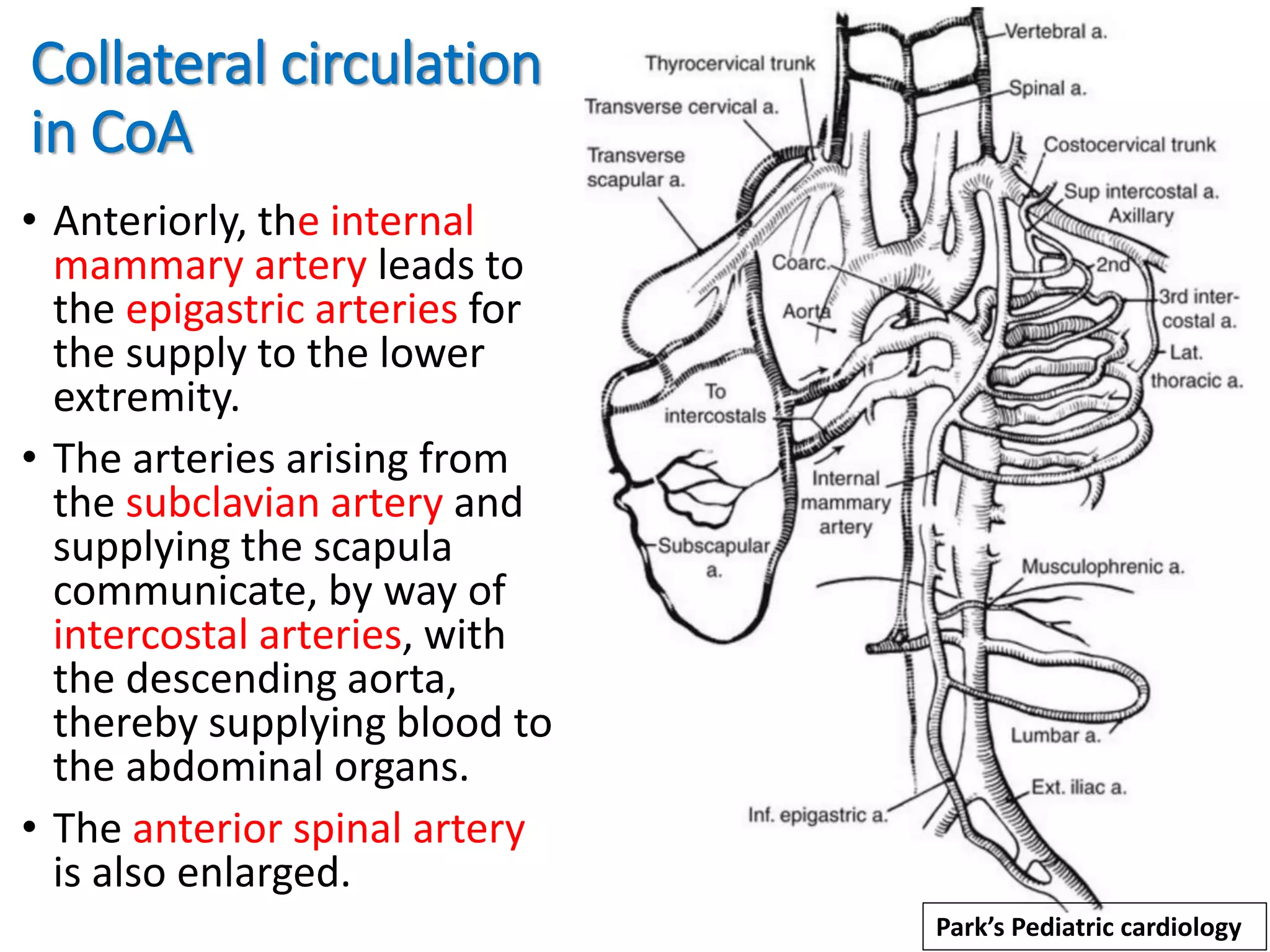 Coarctation of the Aorta | PPTX