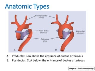 Coarctation of the Aorta | PPTX