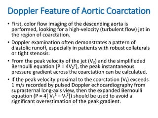 Coarctation of the Aorta | PPT