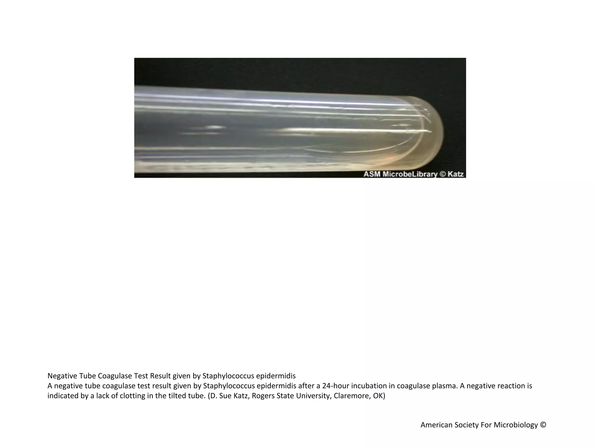 COAGULASE-TEST.pptx | Blood Disorders | Diseases and Conditions