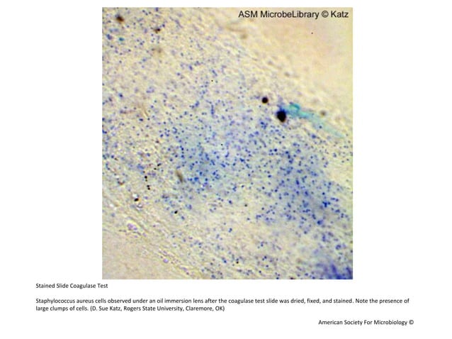 COAGULASE-TEST.pptx | Blood Disorders | Diseases and Conditions