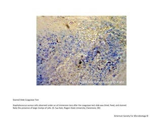 COAGULASE-TEST.pptx