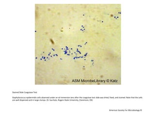 COAGULASE-TEST.pptx