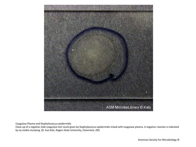 COAGULASE-TEST.pptx | Blood Disorders | Diseases and Conditions