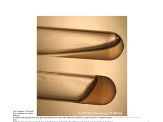 COAGULASE-TEST.pptx | Blood Disorders | Diseases and Conditions