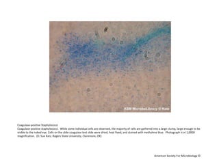 COAGULASE-TEST.pptx