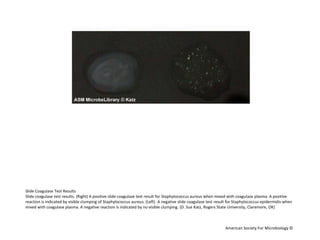 COAGULASE-TEST.pptx