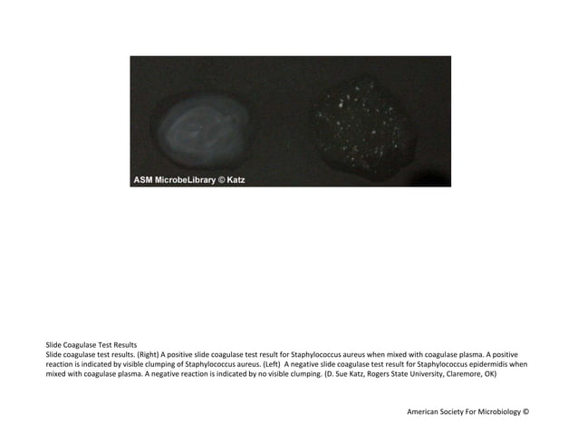 COAGULASE-TEST.pptx | Blood Disorders | Diseases and Conditions