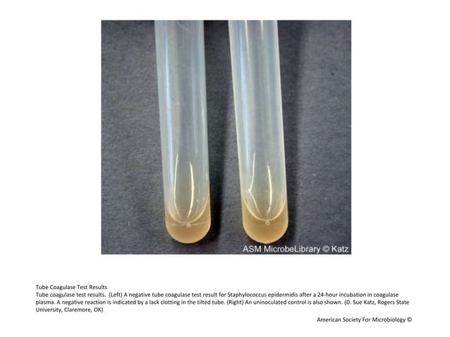 COAGULASE-TEST.pptx | Blood Disorders | Diseases and Conditions