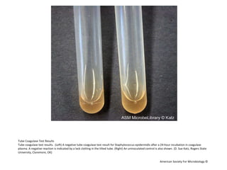 COAGULASE-TEST.pptx