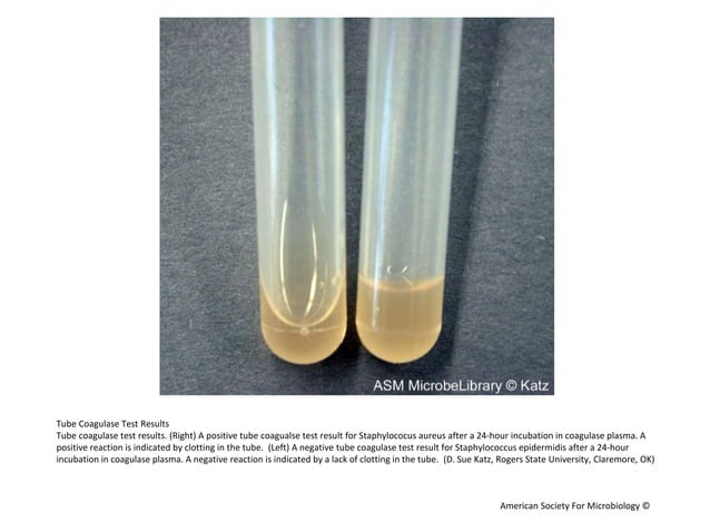 COAGULASE-TEST.pptx | Blood Disorders | Diseases and Conditions