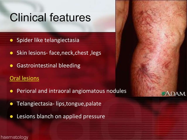 COAGULATION AND BLEEDING DISORDERS.pptx