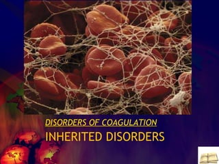 Coagulation Disorders and Anesthesia-Basic pathophysiology | PPT
