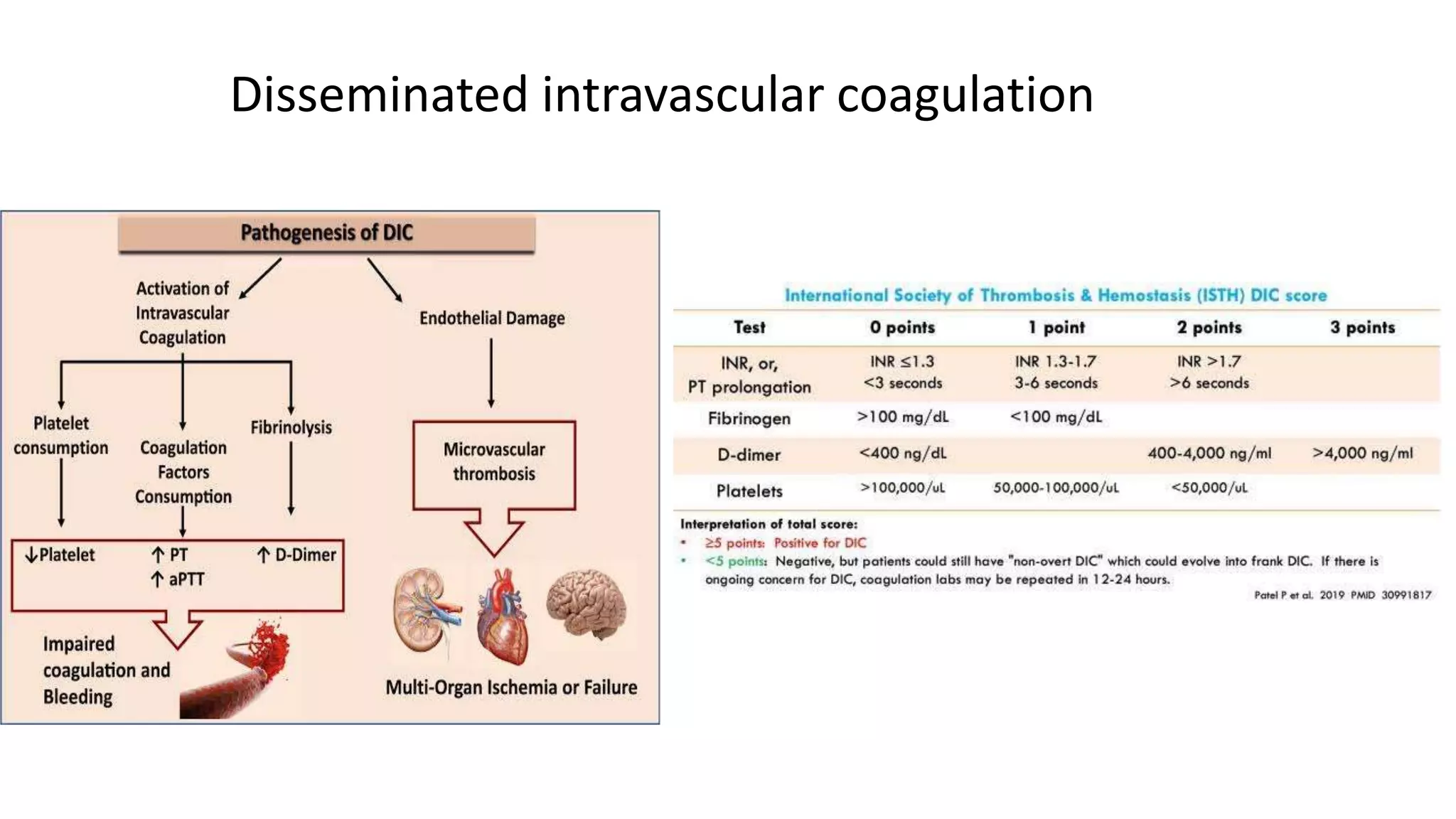 coagulation in CLD ppt.pptx