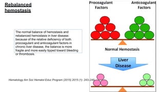 coagulation in CLD ppt.pptx