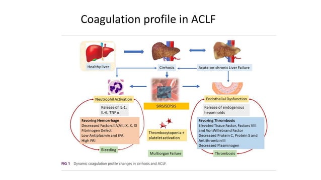 coagulation in CLD ppt.pptx
