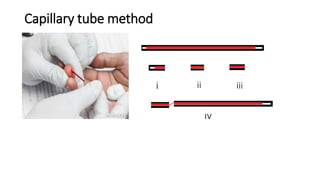 Coagulation profile | PPTX