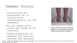 Coalición tarsal - PRESENTACION DE FRACTURAS PEDIATRICAS | PPTX