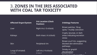 Coaltar Products in the iris interpretation.pptx