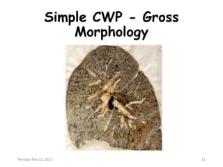 Coal workers pneumoconiosis | PDF