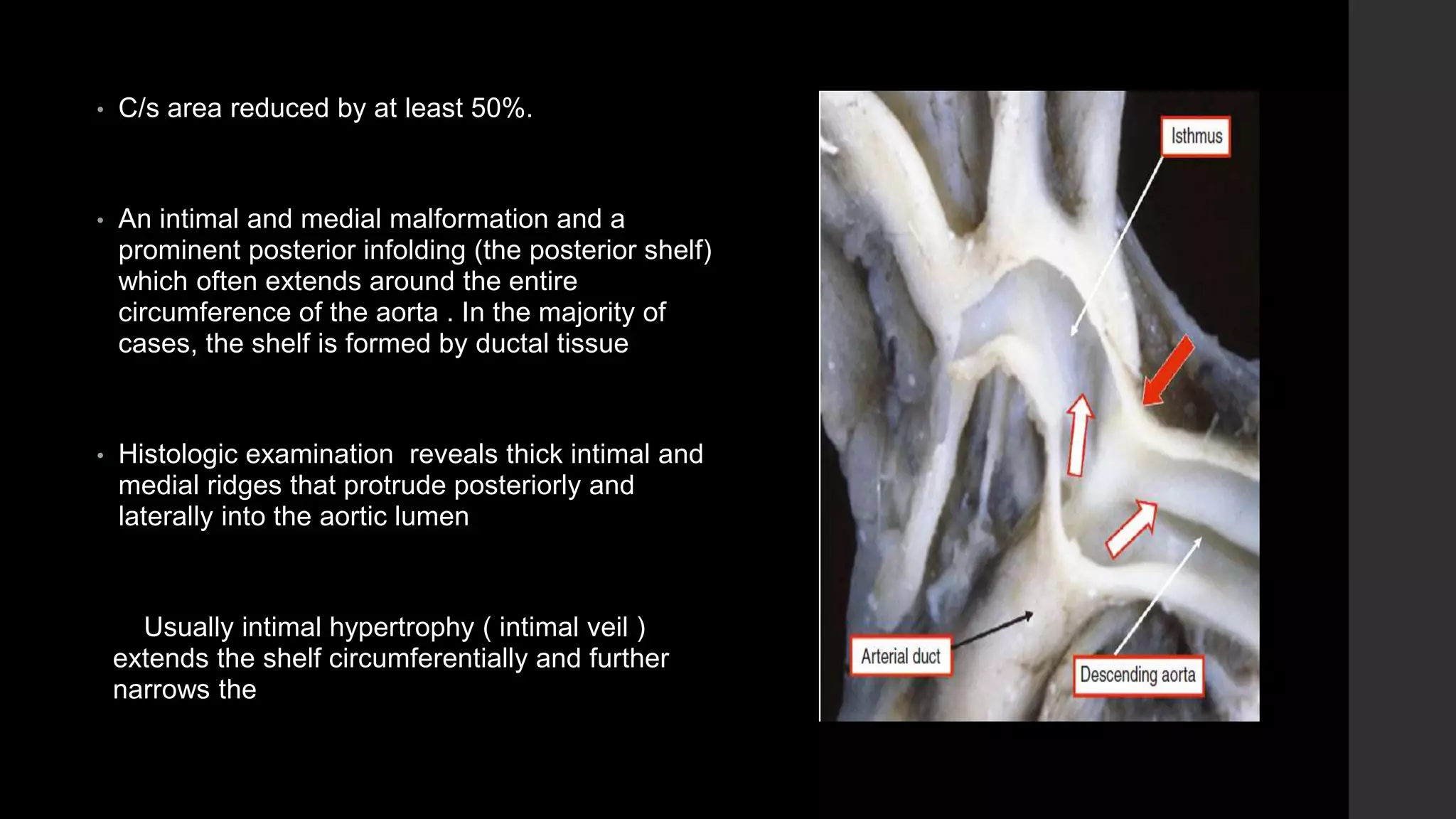 Coa pathophysiology | PPTX