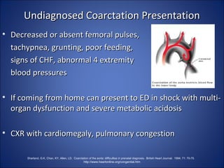Coarctation - Wetzel | PPT
