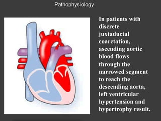 Coarctation of aorta. | PPTX