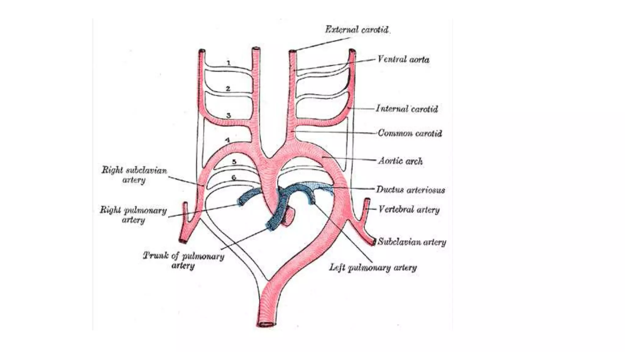 Coarctation of aorta.pptx