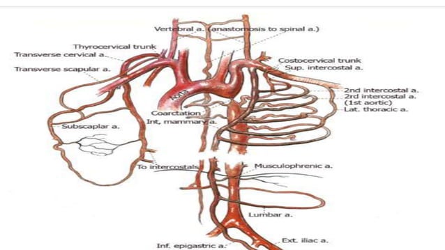 Coarctation of aorta.pptx