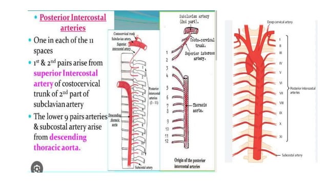 Coarctation of aorta.pptx