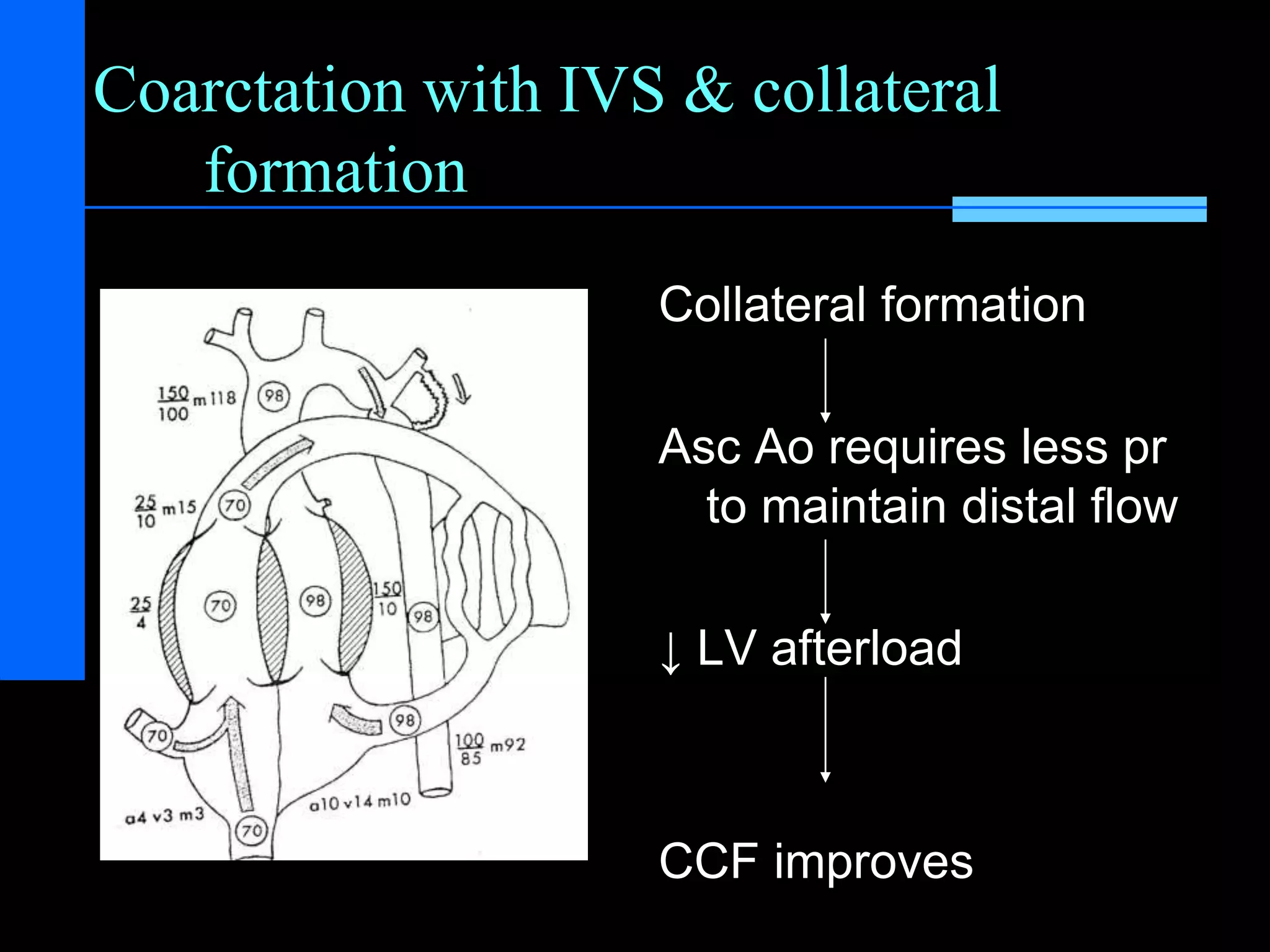 Coarctation of aorta | PPTX