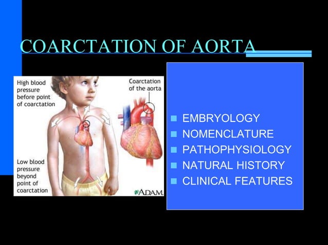 Coarctation of aorta | PPTX