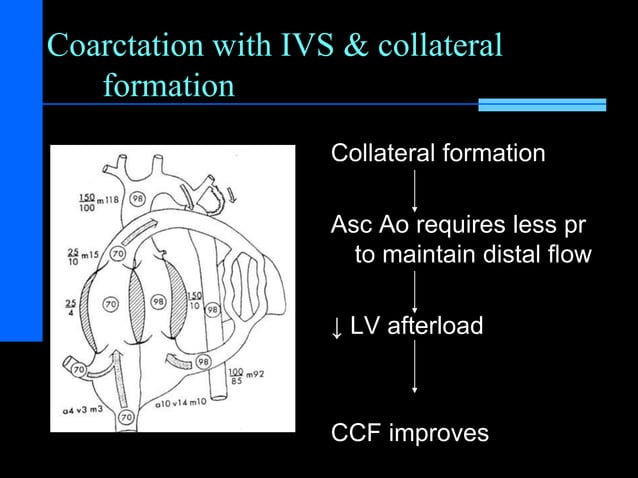 Coarctation of aorta | PPTX