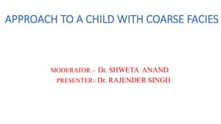 COARSE FACIES (PEDIATRICS ).pptx pediatrics | PPTX