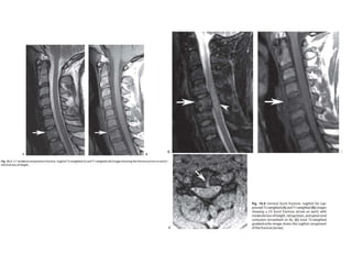 how to read spine mri | PPTX