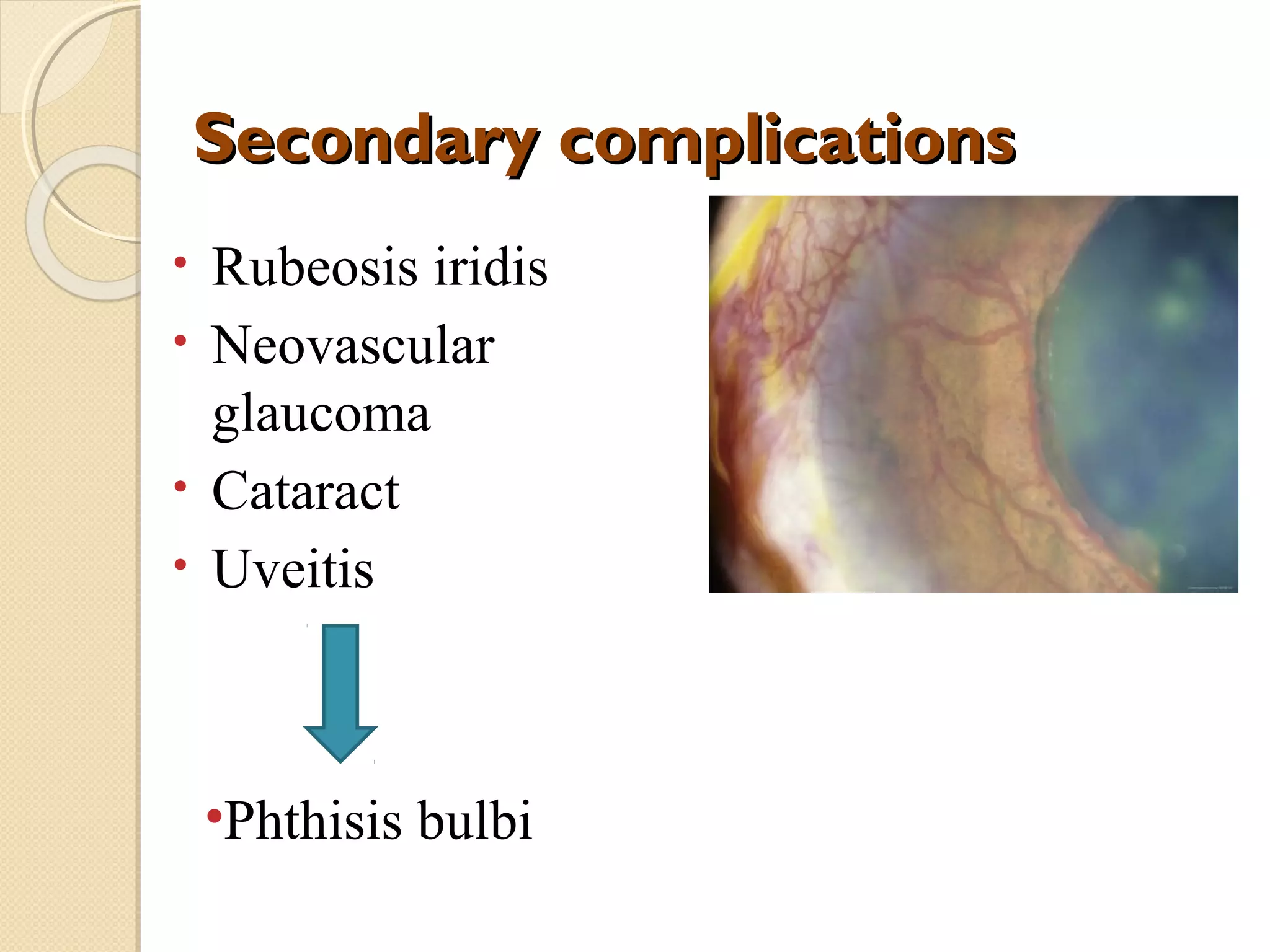 Coats' Disease | PPT