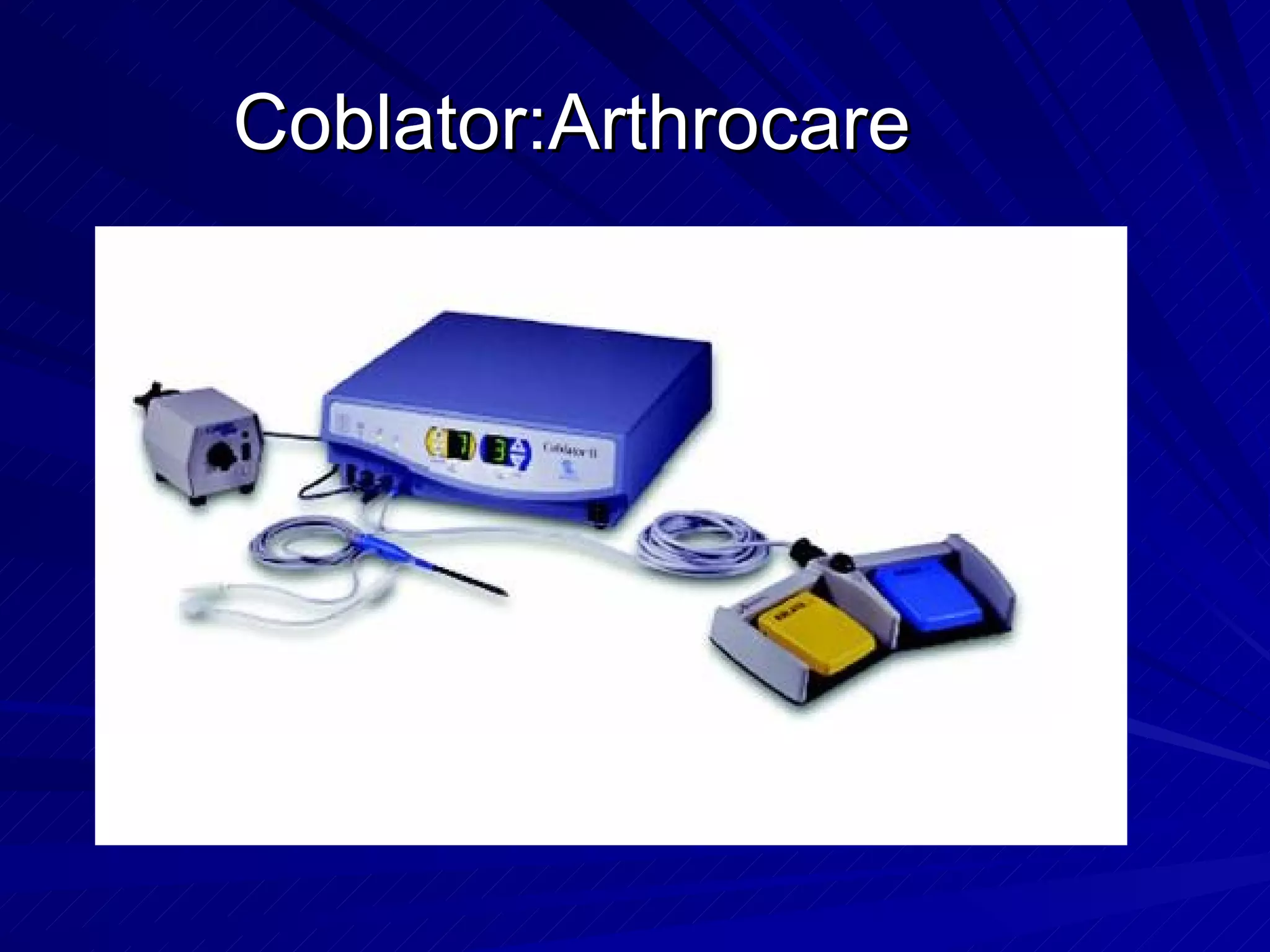 Coblator and laser surgery in ENT:Jubilee Hospital, Trivandrum, south ...
