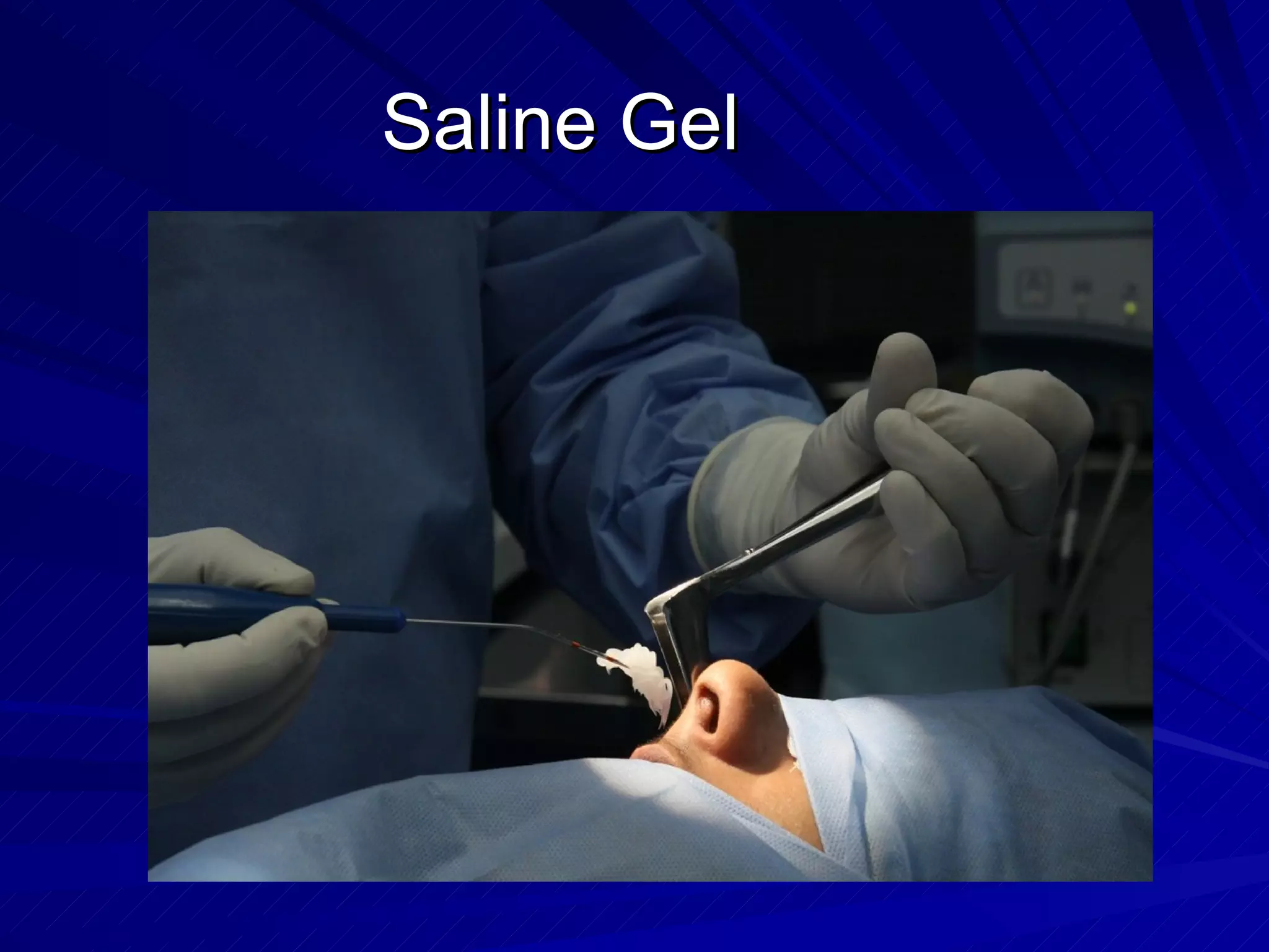 Coblator and laser surgery in ENT:Jubilee Hospital, Trivandrum, south ...