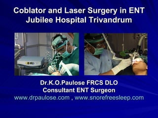 Coblator and laser surgery in ENT:Jubilee Hospital, Trivandrum, south ...
