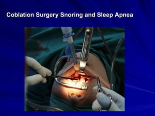 Coblator and laser surgery in ENT:Jubilee Hospital, Trivandrum, south ...