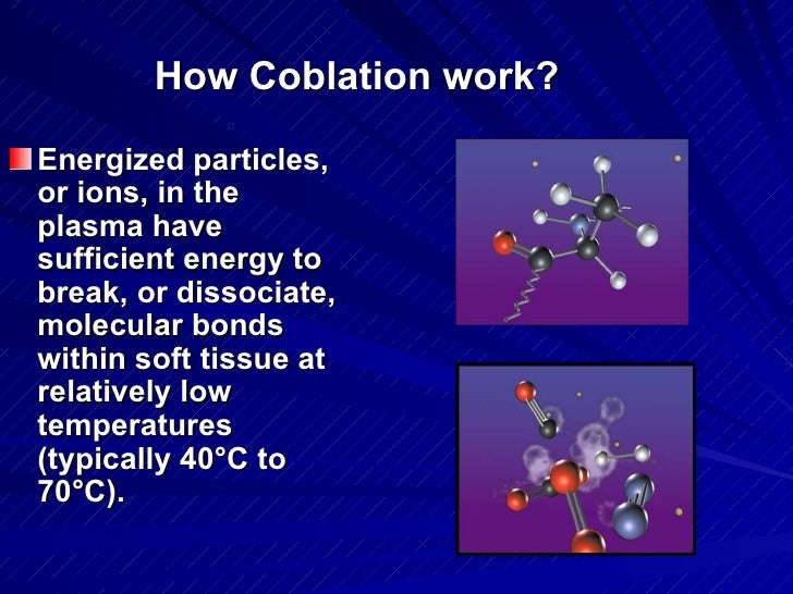 Coblator and laser surgery in ENT:Jubilee Hospital, Trivandrum, south…