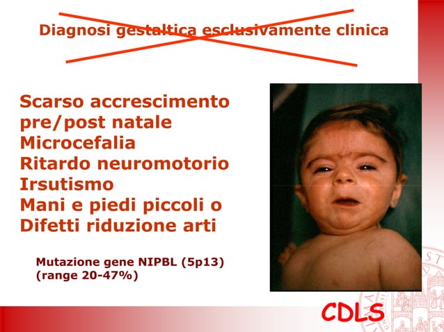 Cocchi sindrome di williams | PDF