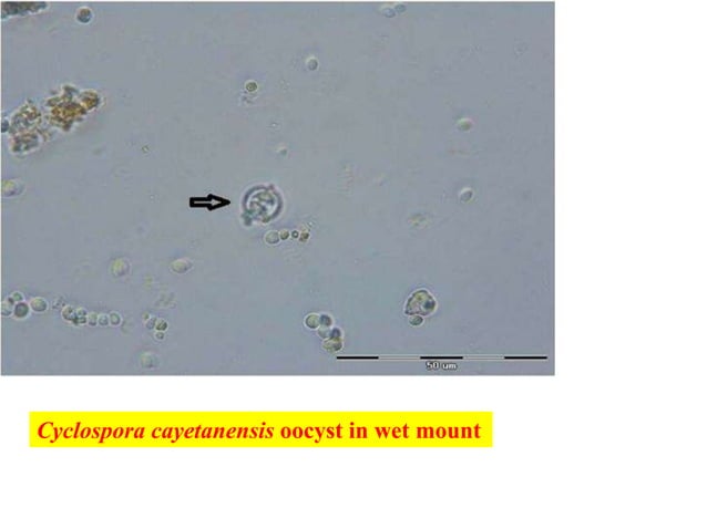 Coccidian parasites -Cyclospora cayetanensis | PPTX